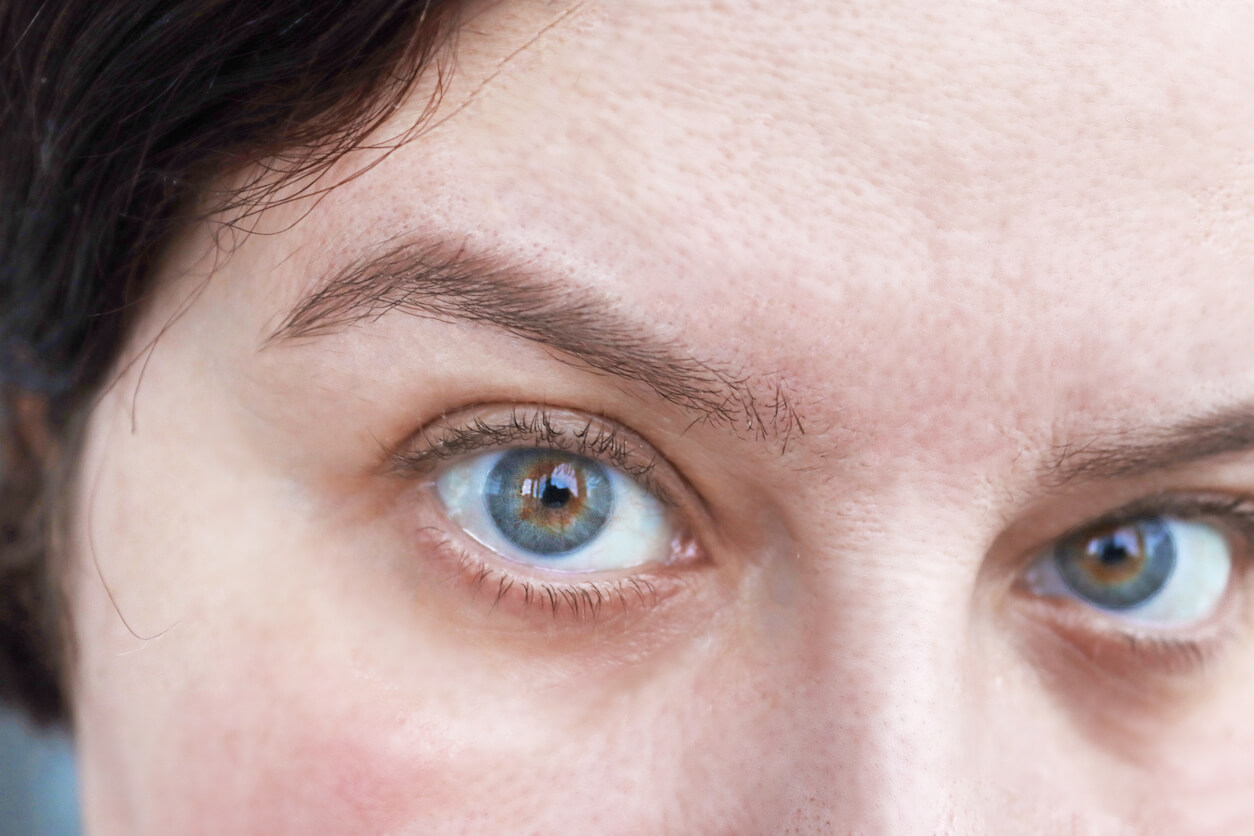 Elevación de cejas: en qué consiste y tratamientos disponibles - Smart ...